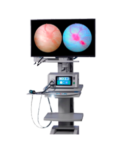 Bladder Cancer: Blue light cystoscopy - Imagin Medical